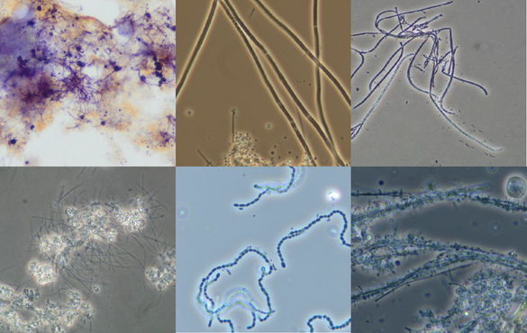 Understanding the Impact of Filaments in Wastewater Treatment Plants